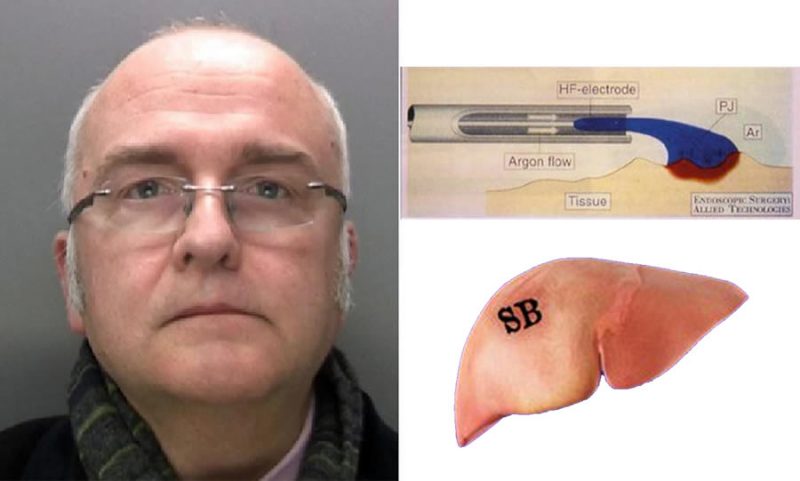 This doc burned his initials into the livers of two patients – Foxella