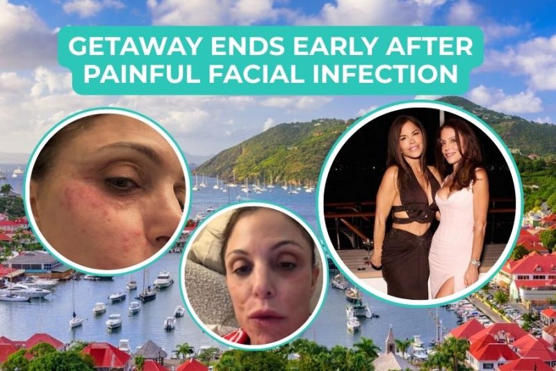 Bethenny Frankel’s St. Barths getaway ends early after painful facial ...